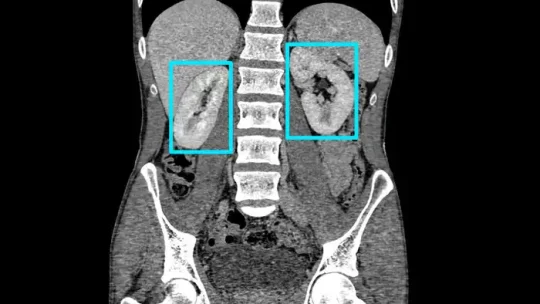 Medical Data Annotation - Accelerating your AI potential